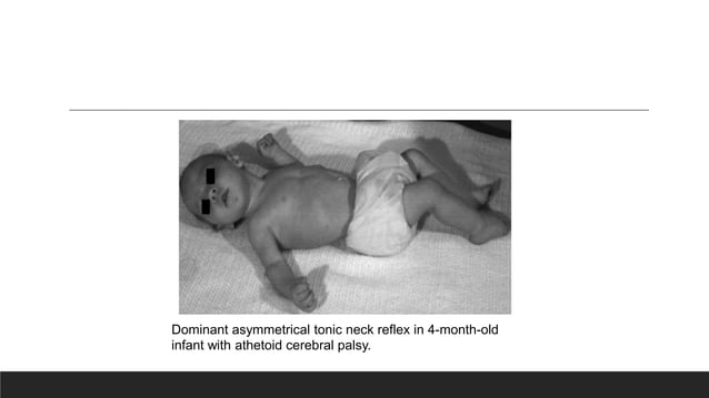 early intervention in high risk infants.pptx | Pregnancy | Reproductive ...