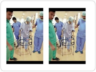 Early mobilisation in ICU | PPTX