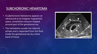 Early OG USG Protocol (1).pptx