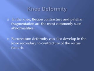 Early Physiotherapy and Management of Deformities.pptx