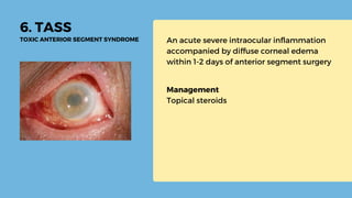 Early post operative complications of cataract surgery_20230914_004137 ...