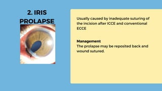 Early post operative complications of cataract surgery_20230914_004137 ...