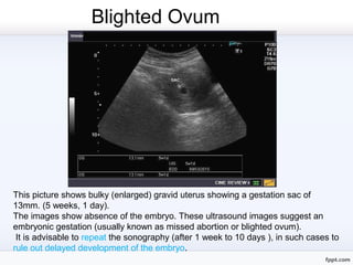 Early pregnancy | PPT