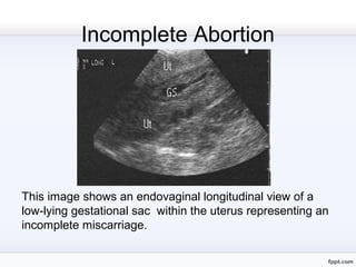 Early pregnancy | PPT