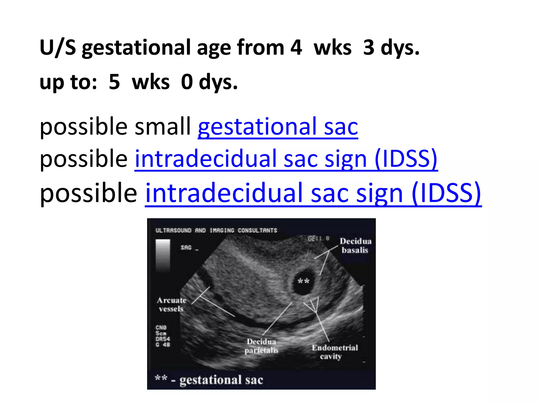 Ultrasound diagnosis of early pregnancy and cutoff measurements of ...