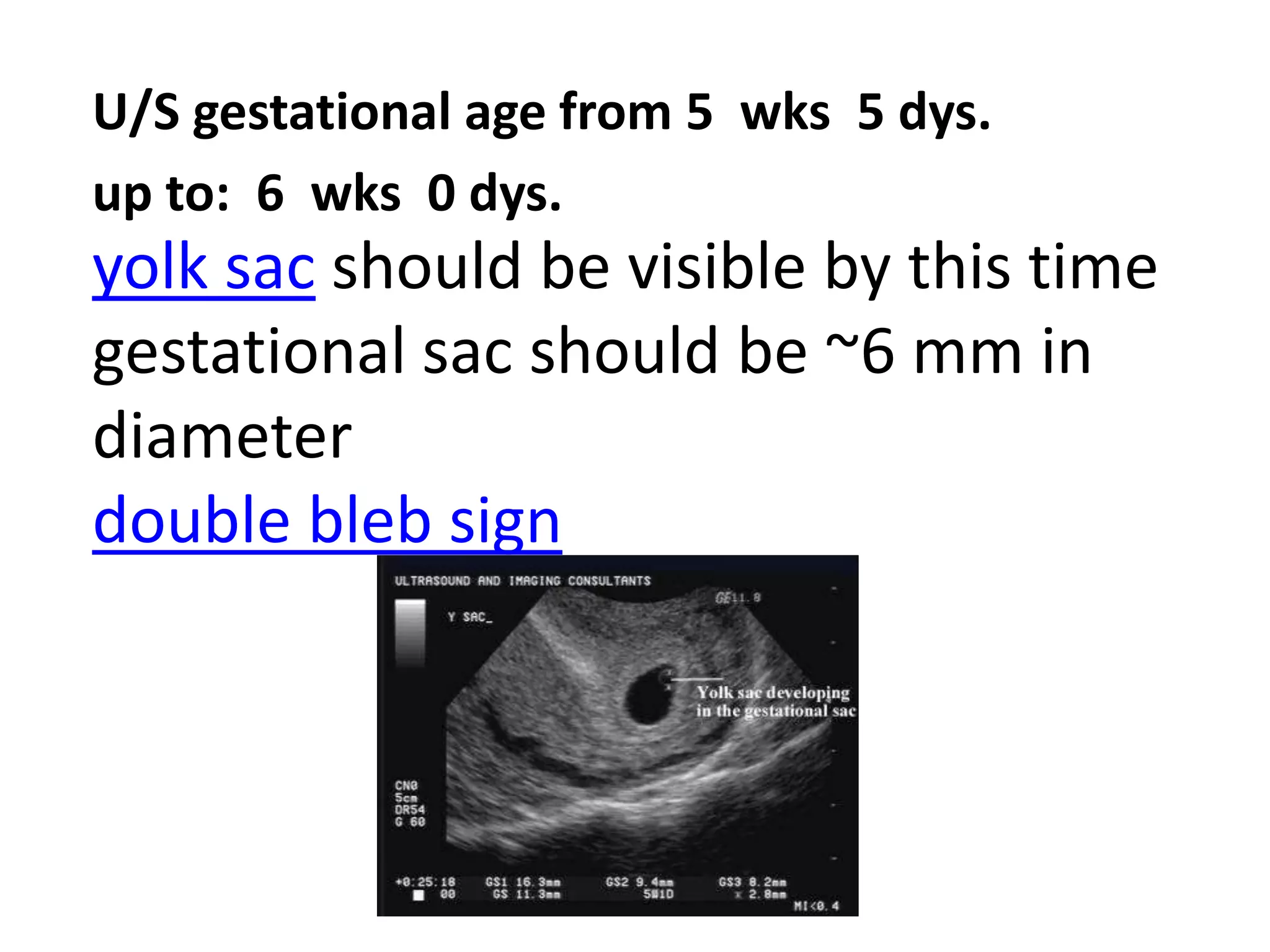 Ultrasound diagnosis of early pregnancy and cutoff measurements of ...