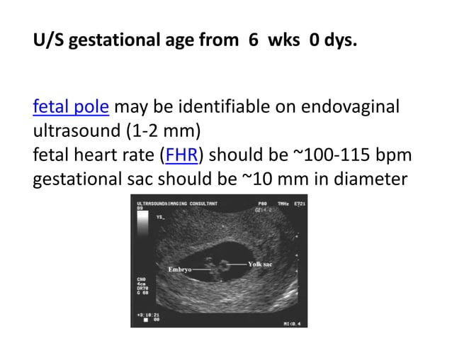 Ultrasound diagnosis of early pregnancy and cutoff measurements of ...