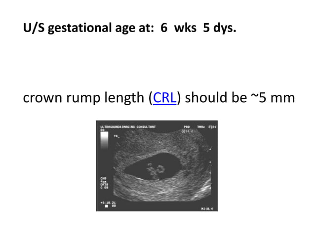 Ultrasound diagnosis of early pregnancy and cutoff measurements of ...