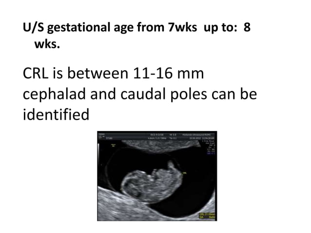 Ultrasound diagnosis of early pregnancy and cutoff measurements of ...