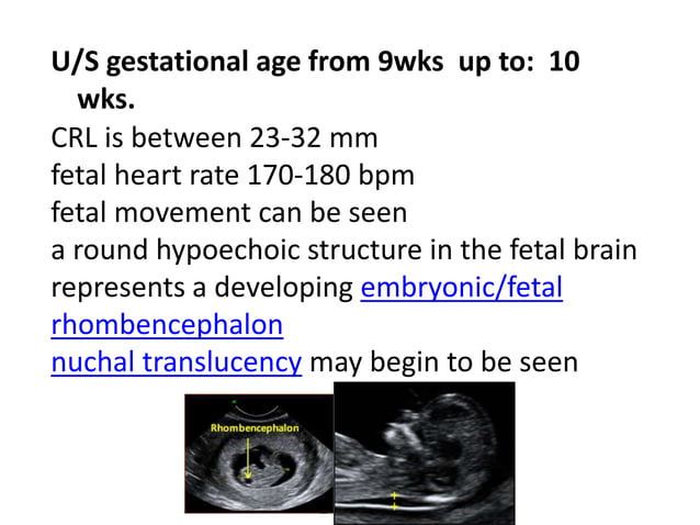 Ultrasound diagnosis of early pregnancy and cutoff measurements of ...