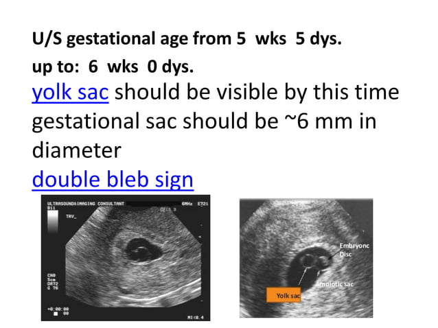 Ultrasound diagnosis of early pregnancy and cutoff measurements of ...