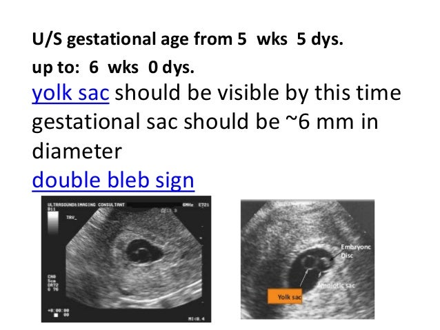 Ultrasound diagnosis of early pregnancy and cutoff measurements of ea…