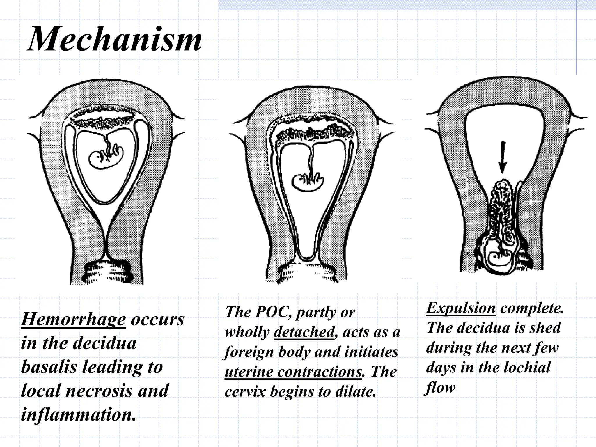 Early pregnancy bleeding .ppt by Dr. Rabirra | PPT