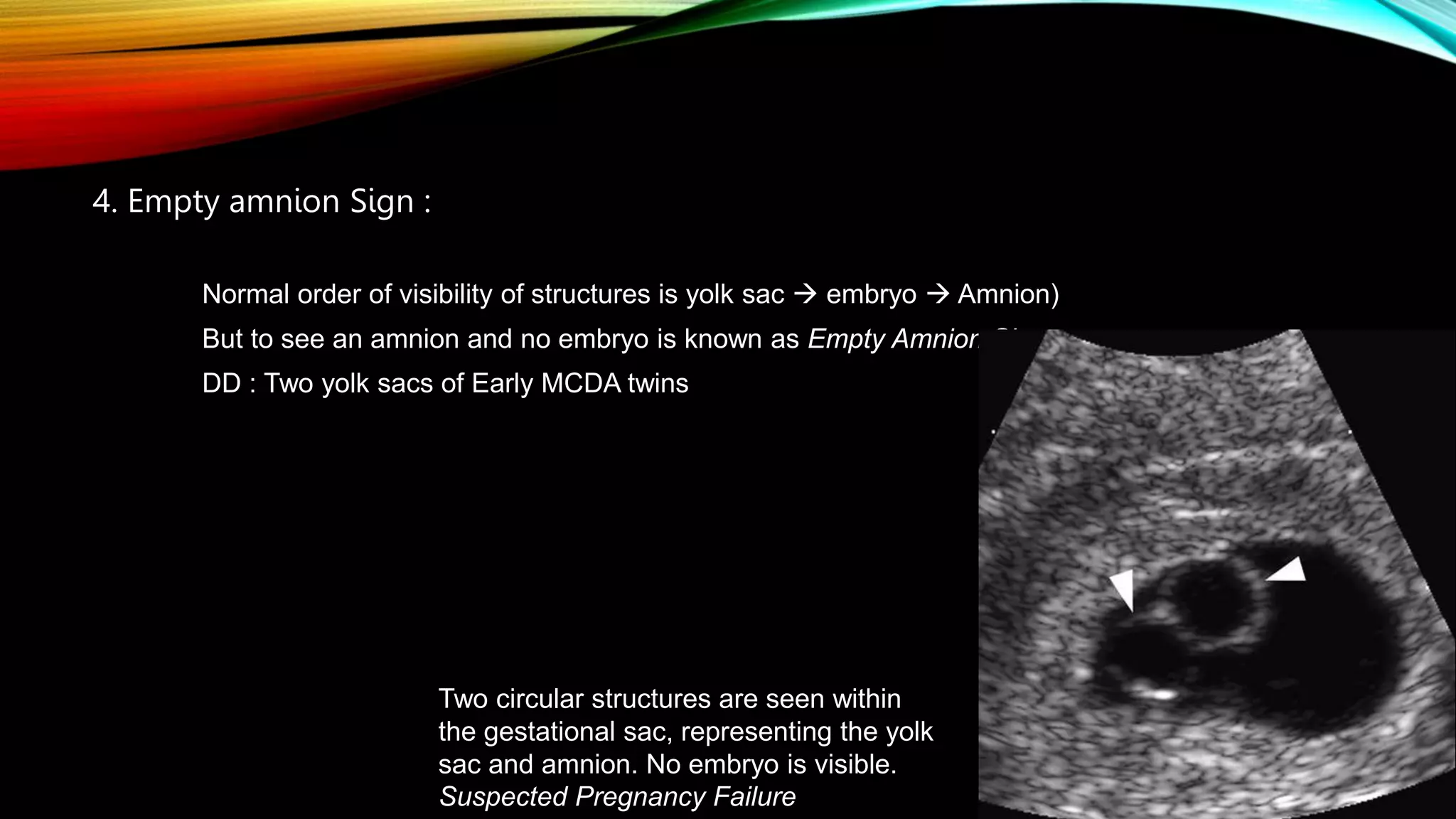 EARLY Pregnancy failure.pptx