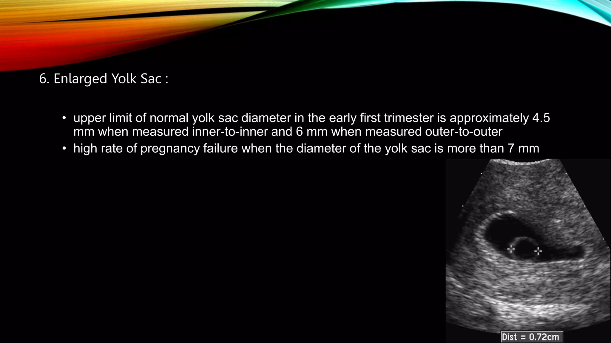 EARLY Pregnancy failure.pptx
