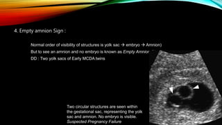 EARLY Pregnancy failure.pptx