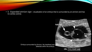 EARLY Pregnancy failure.pptx