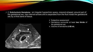 EARLY Pregnancy failure.pptx