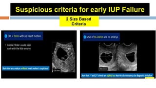 Early Pregnancy Loss a Simplified Ultrasound Approche Dr/ Ahmed Walid ...