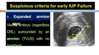 Early Pregnancy Loss a Simplified Ultrasound Approche Dr/ Ahmed Walid ...
