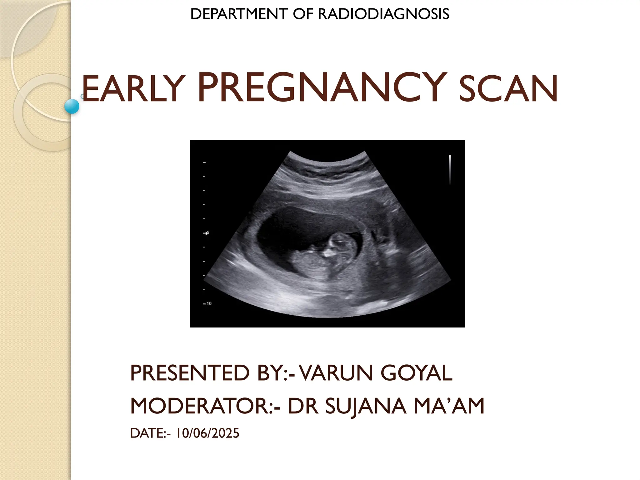 EARLY PREGNANCY SCAN by department of radiology | PPTX