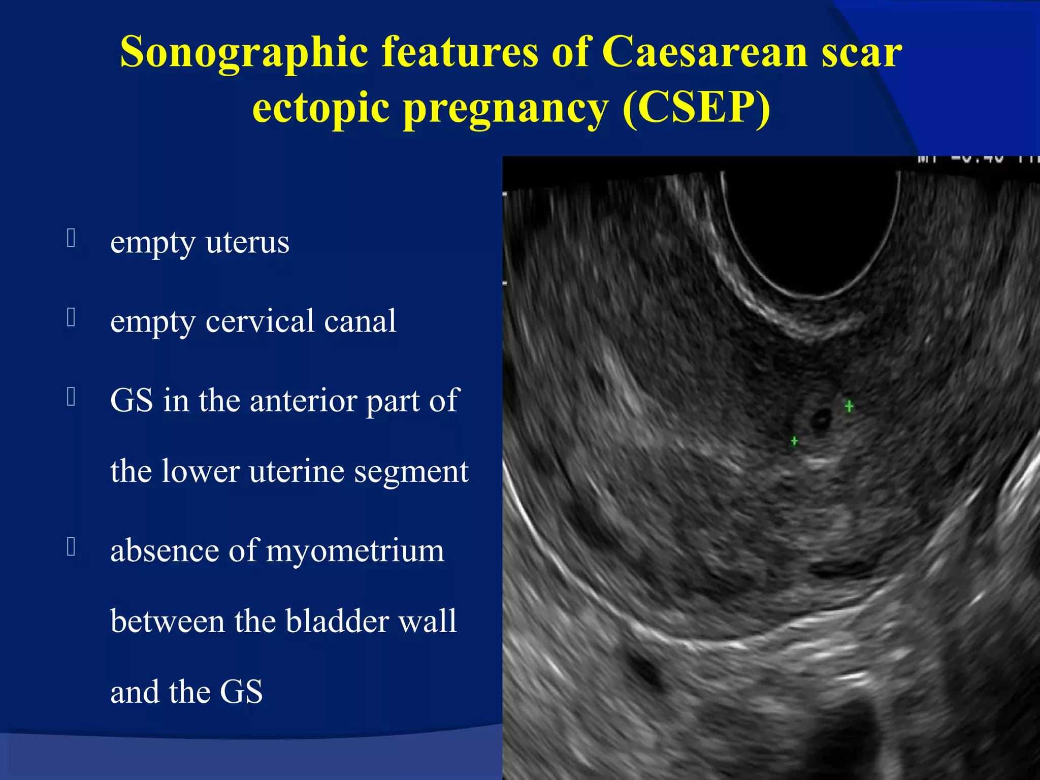 Early pregnancy ultrasonographic evaluation | PPT