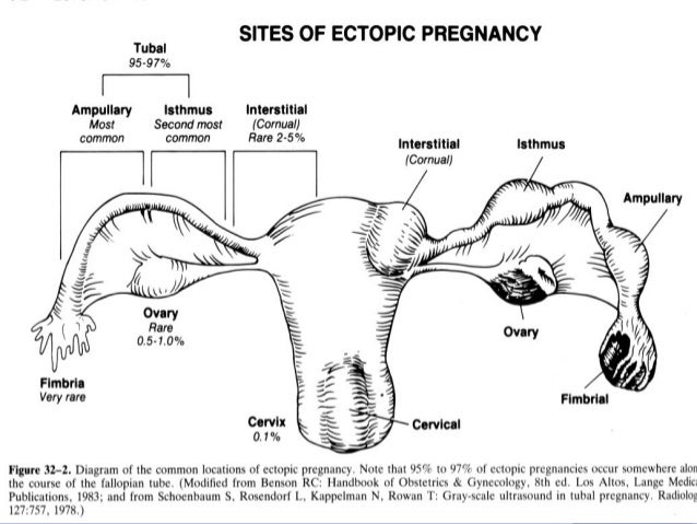 Early pregnancy ultrasonographic evaluation