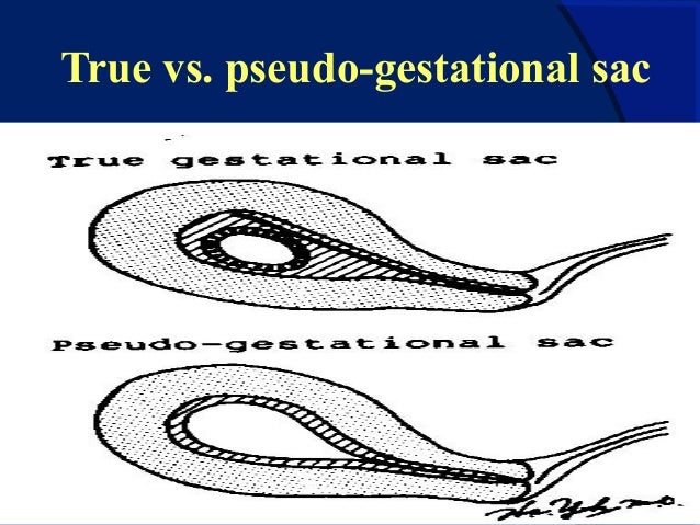 Early pregnancy ultrasonographic evaluation