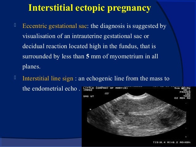 Early pregnancy ultrasonographic evaluation