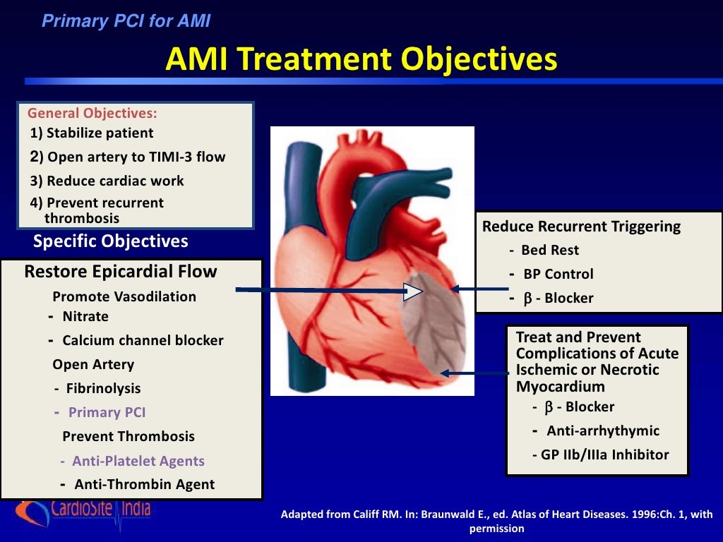 Treatments Of Myocardial Infarction at Jack Radcliffe blog