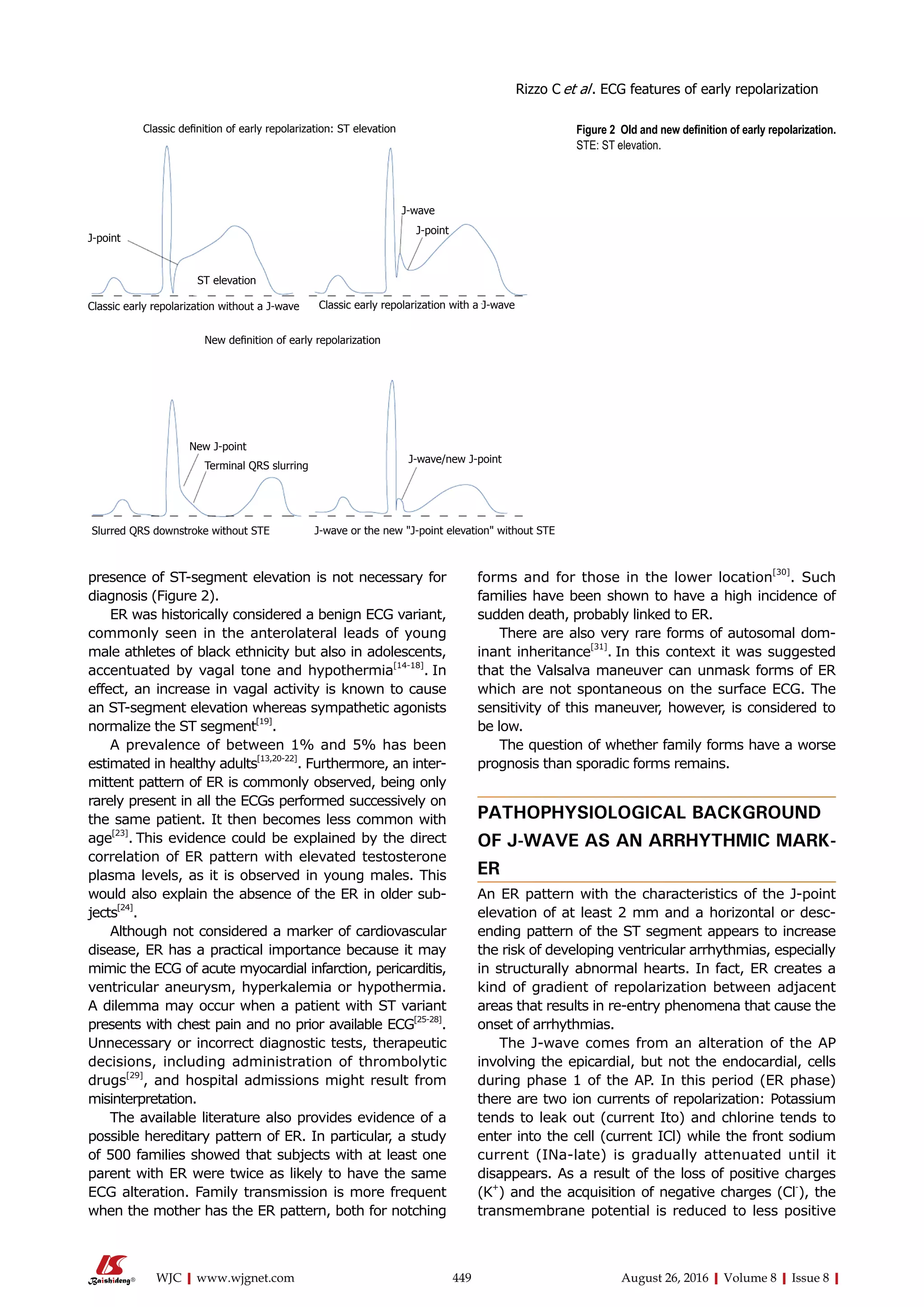 Early repolarization | PDF