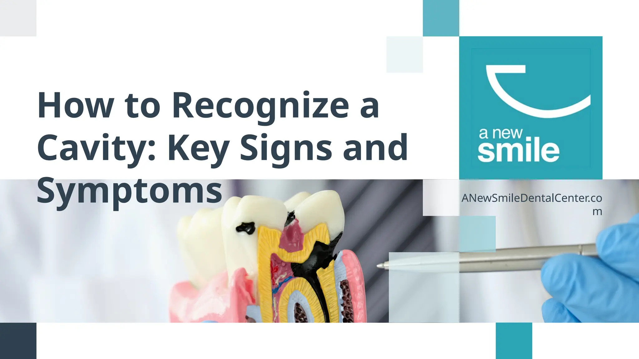 Early Signs and Symptoms of Cavities: What to Know | PPT