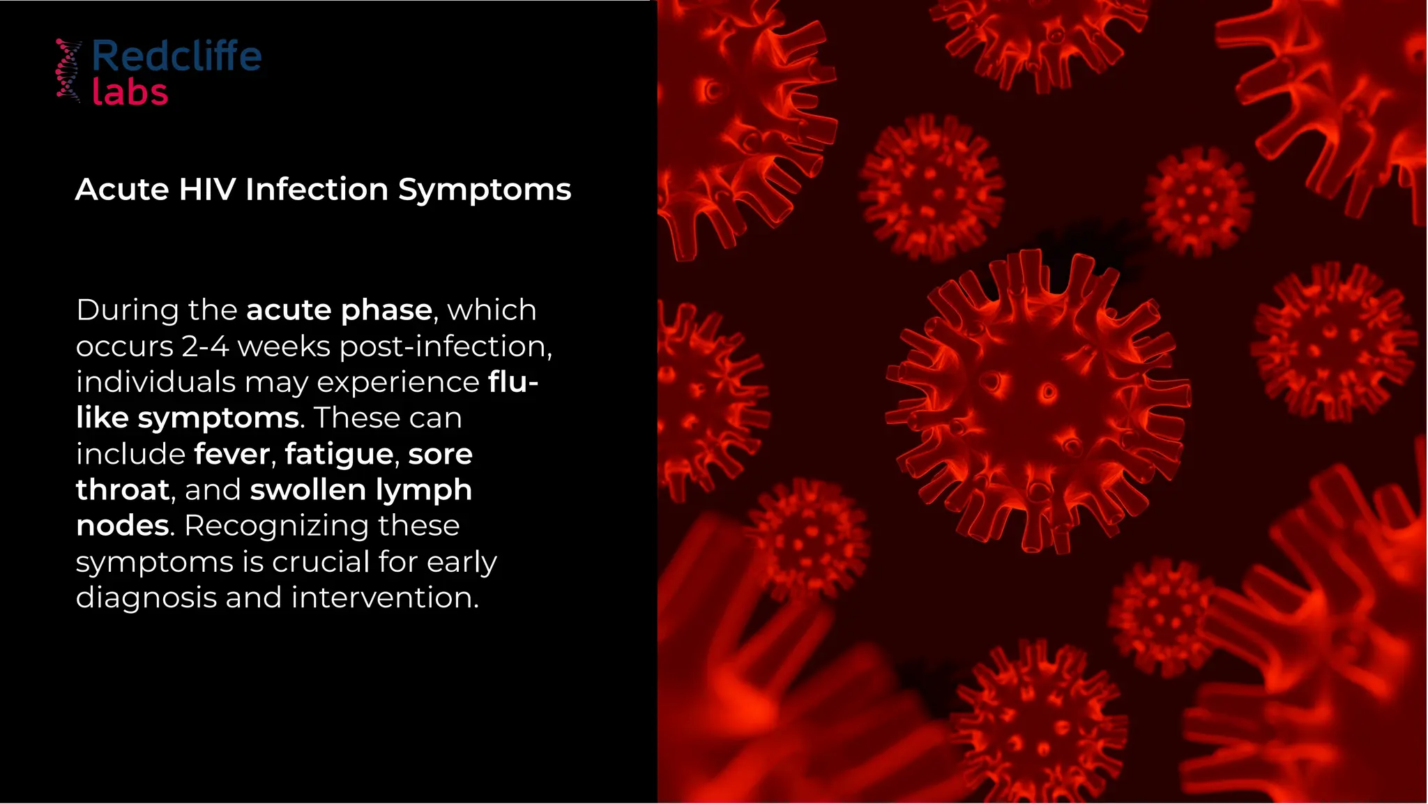 Early Signs and Symptoms of HIV Infection.pdf