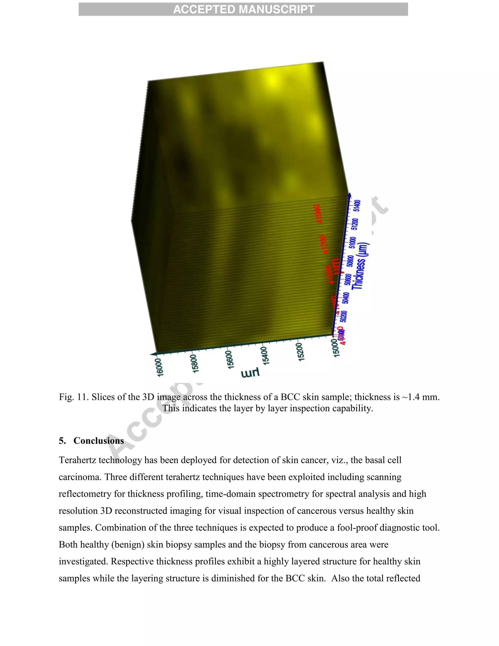 Early stage detection of skin cancer via terahertz spectral profiling and 3D imaging | PDF