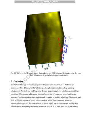 Early stage detection of skin cancer via terahertz spectral profiling and 3D imaging | PDF