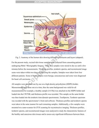 Early stage detection of skin cancer via terahertz spectral profiling ...