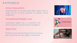 EARLY STAGE PROSTATE CANCER CAUSES, DIAGNOSIS, AND TREATMENT.pdf