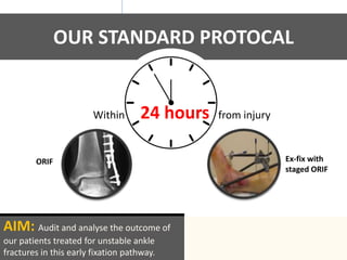 Early surgical stablisation pathway for isolated unstable ankle | PPT