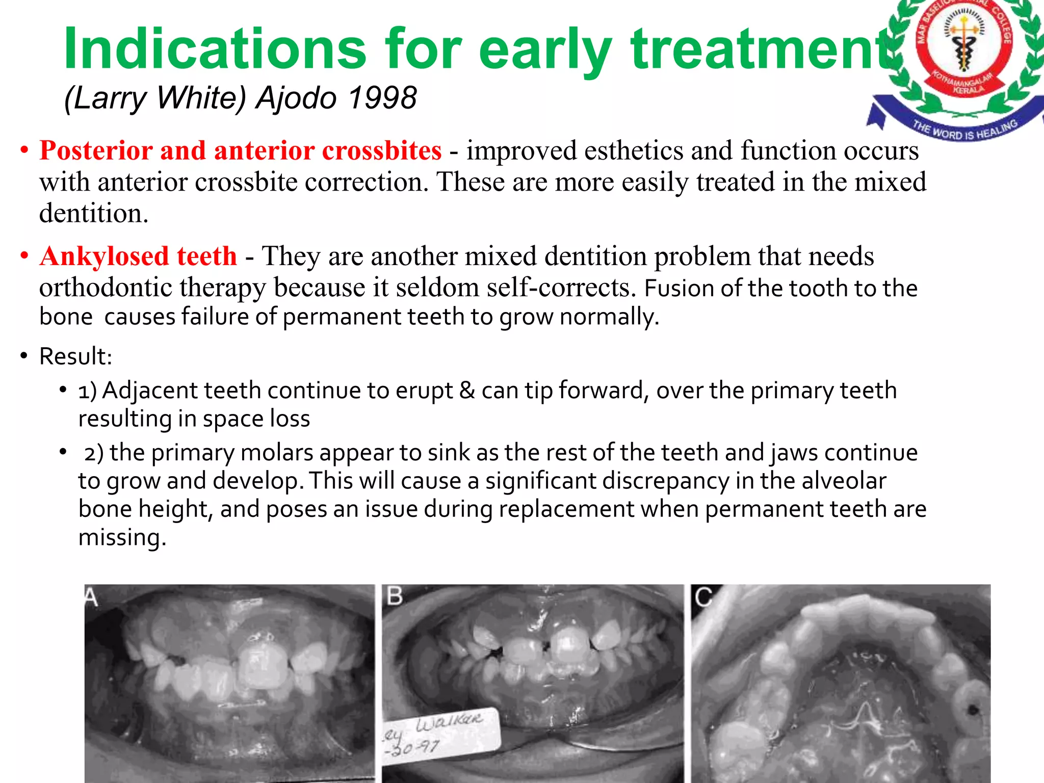 EARLY VERSUS LATE ORTHODONTIC TREATMENT.pptx