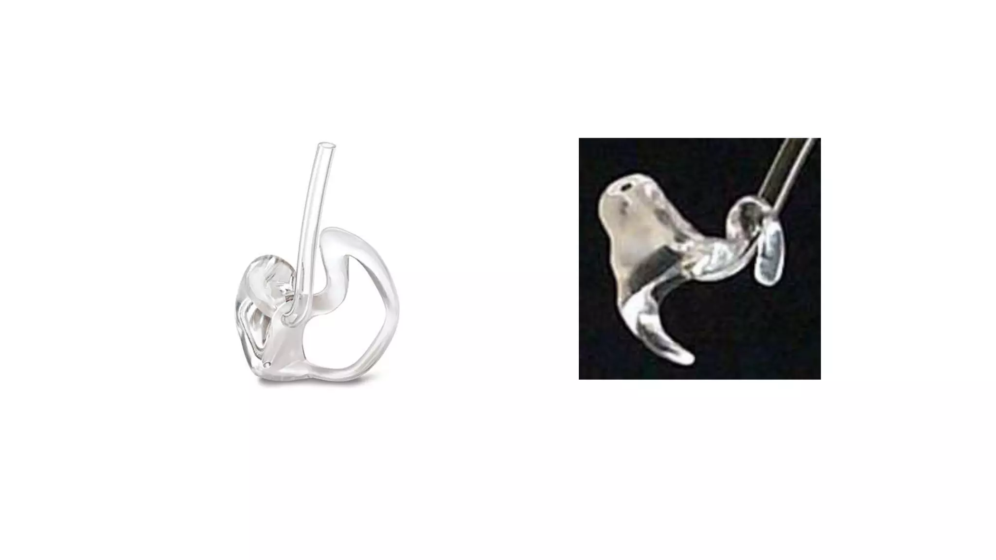 Ear molds | PPTX