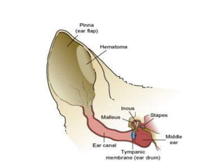Ear new affection of ear and its treatment | PPTX