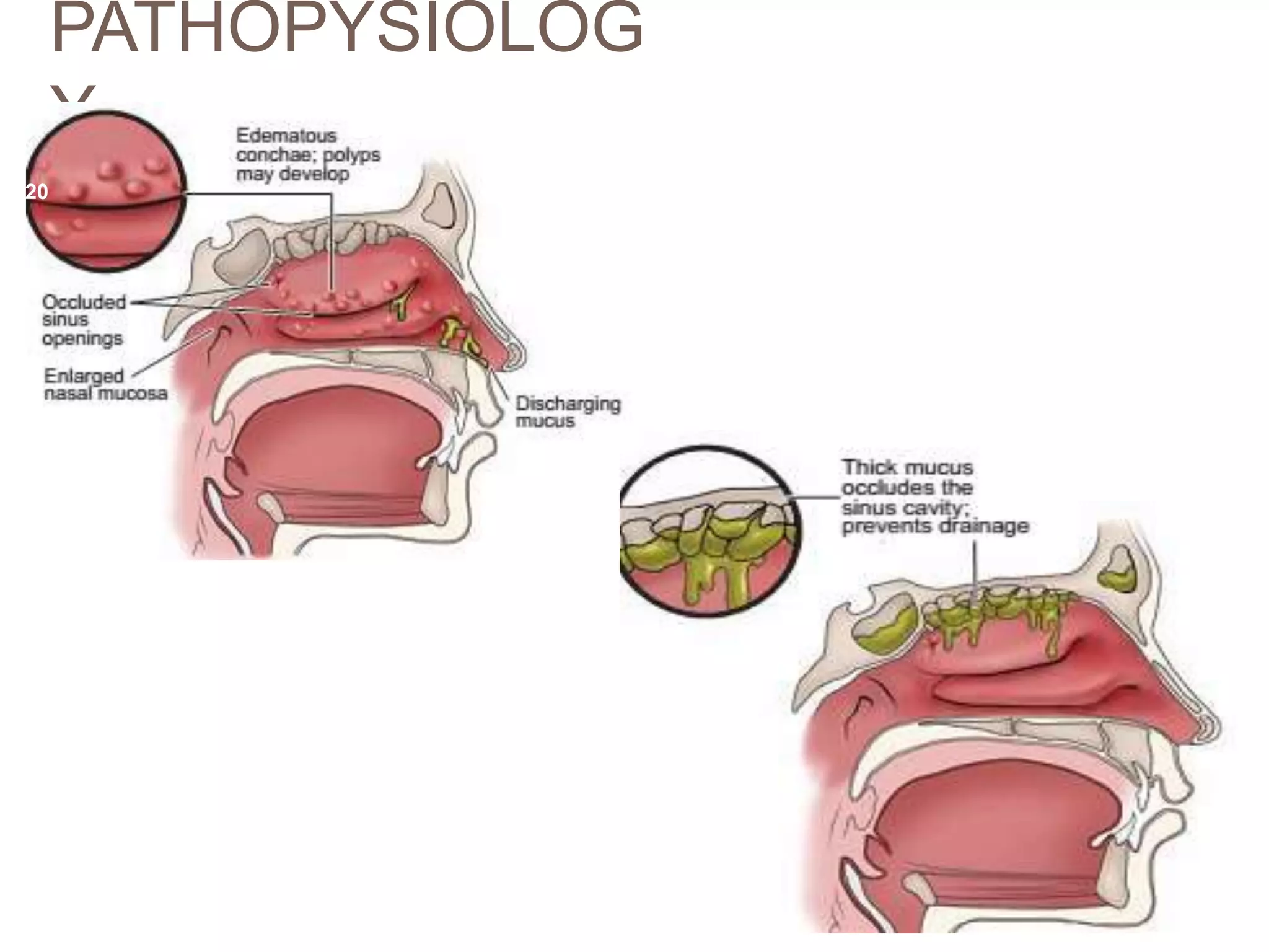 EAR, NOSE AND THROAT.pptx | Ear, Nose and Throat Conditions | Diseases and Conditions