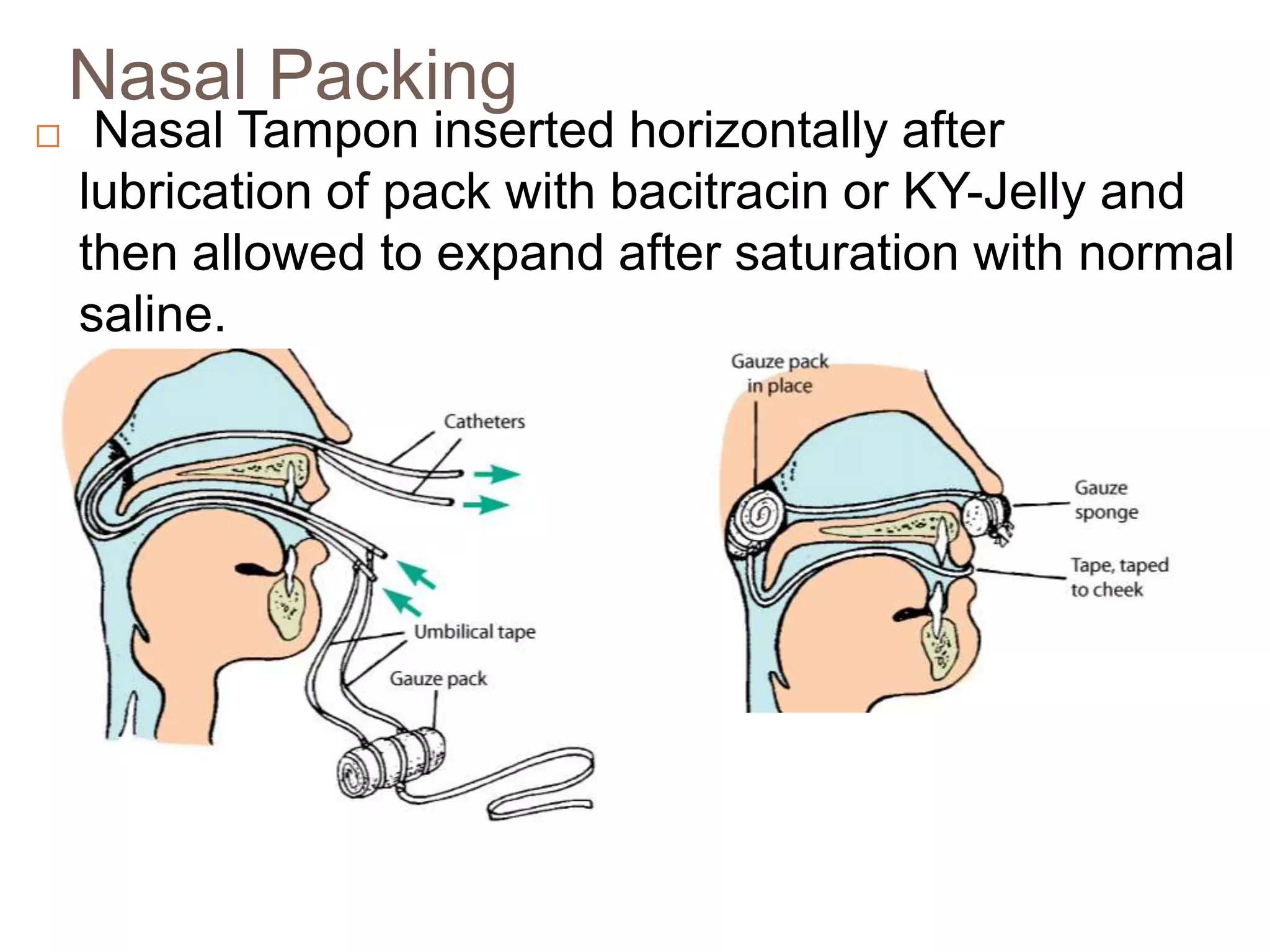EAR, NOSE AND THROAT.pptx