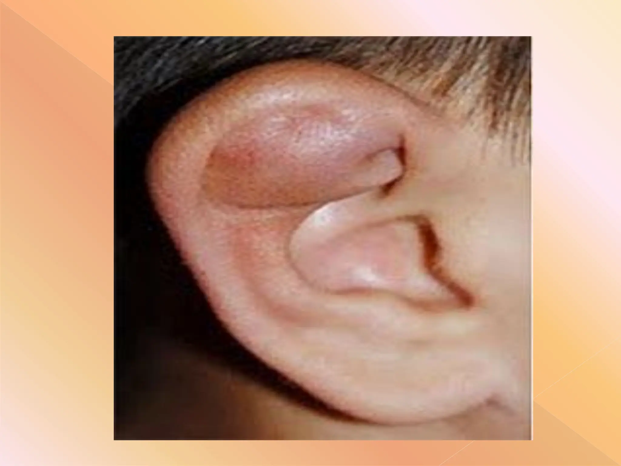 ear pptx.pdf