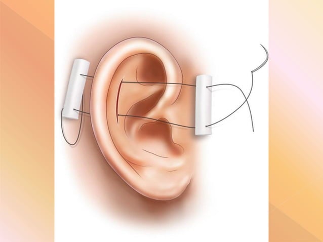 ear pptx.pdf