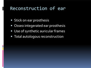 ear reconstruction.pptx