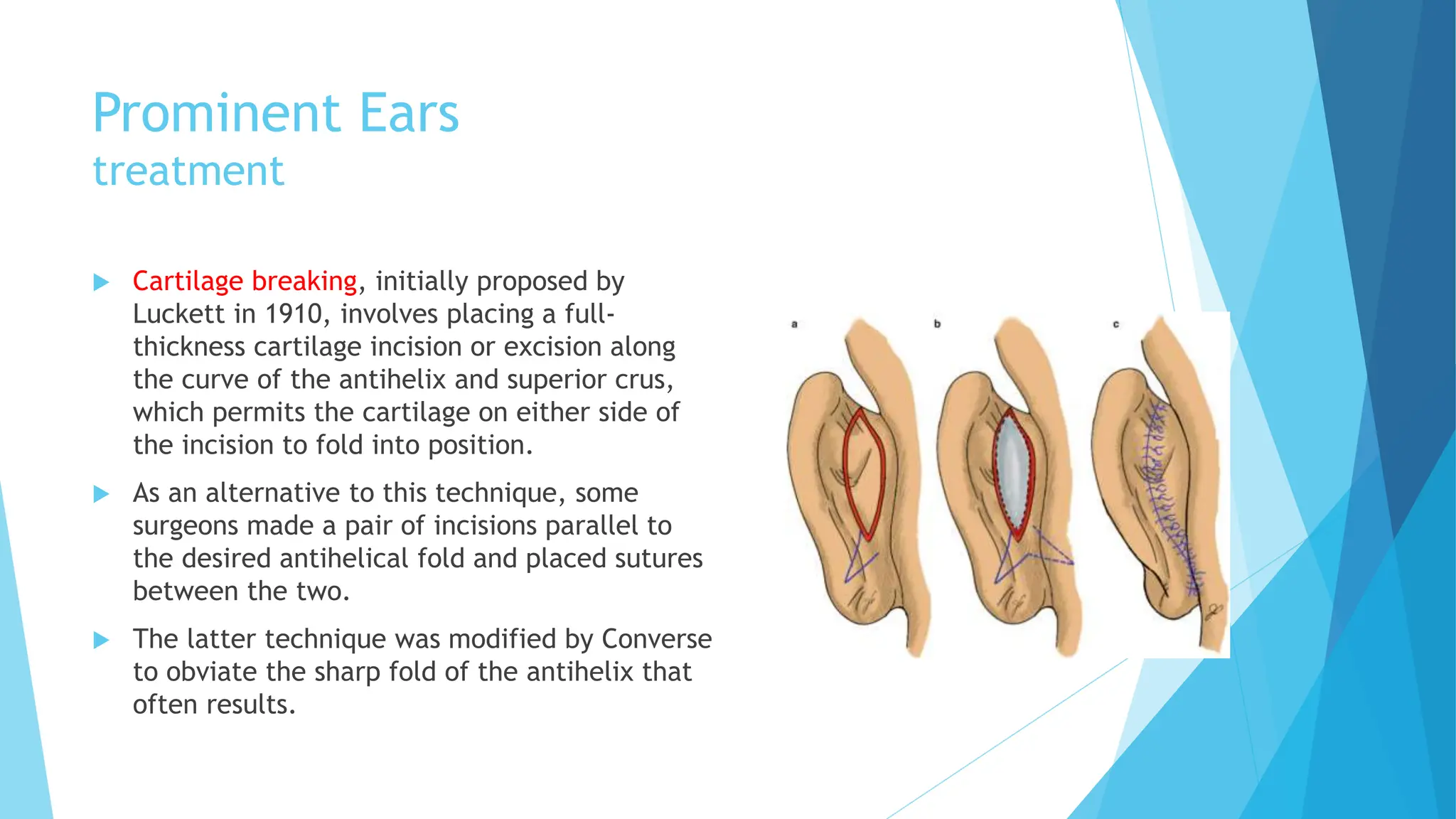 Ear Reconstruction_084051.pptx | Ear, Nose and Throat Conditions | Diseases and Conditions