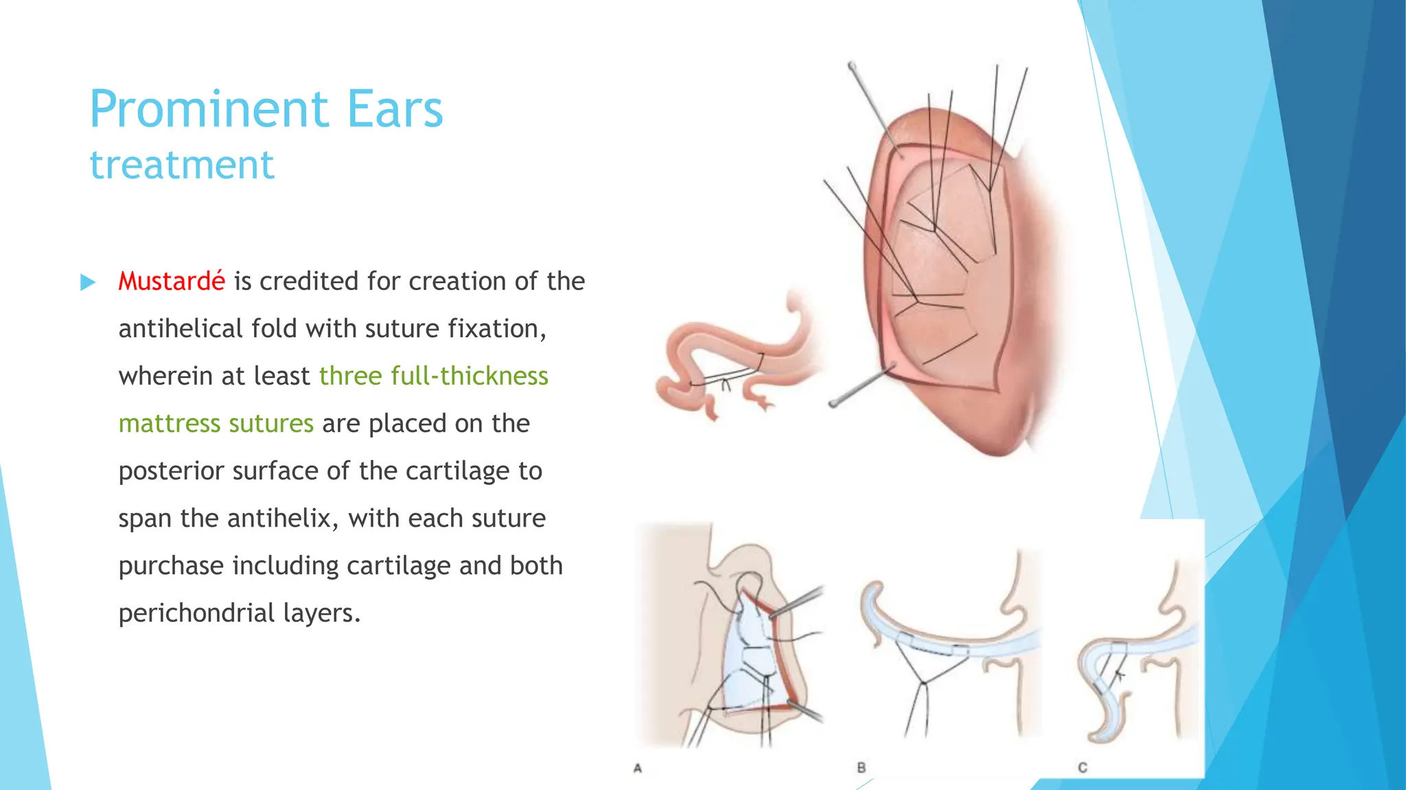 Ear Reconstruction_084051.pptx | Ear, Nose and Throat Conditions | Diseases and Conditions