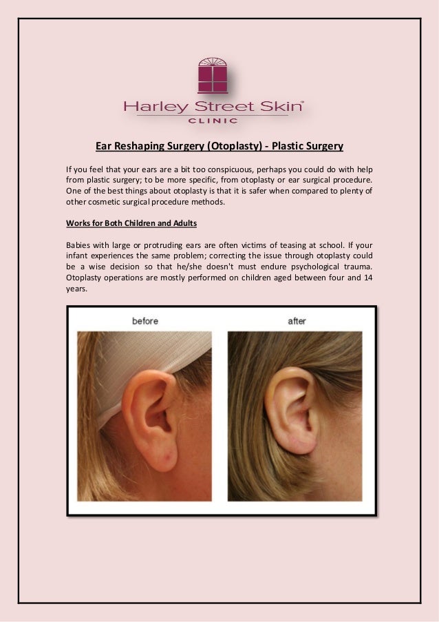 Ear Reshaping Surgery (Otoplasty) - Plastic Surgery Ear Reshaping Surgery (Otoplasty) - Plastic Surgery