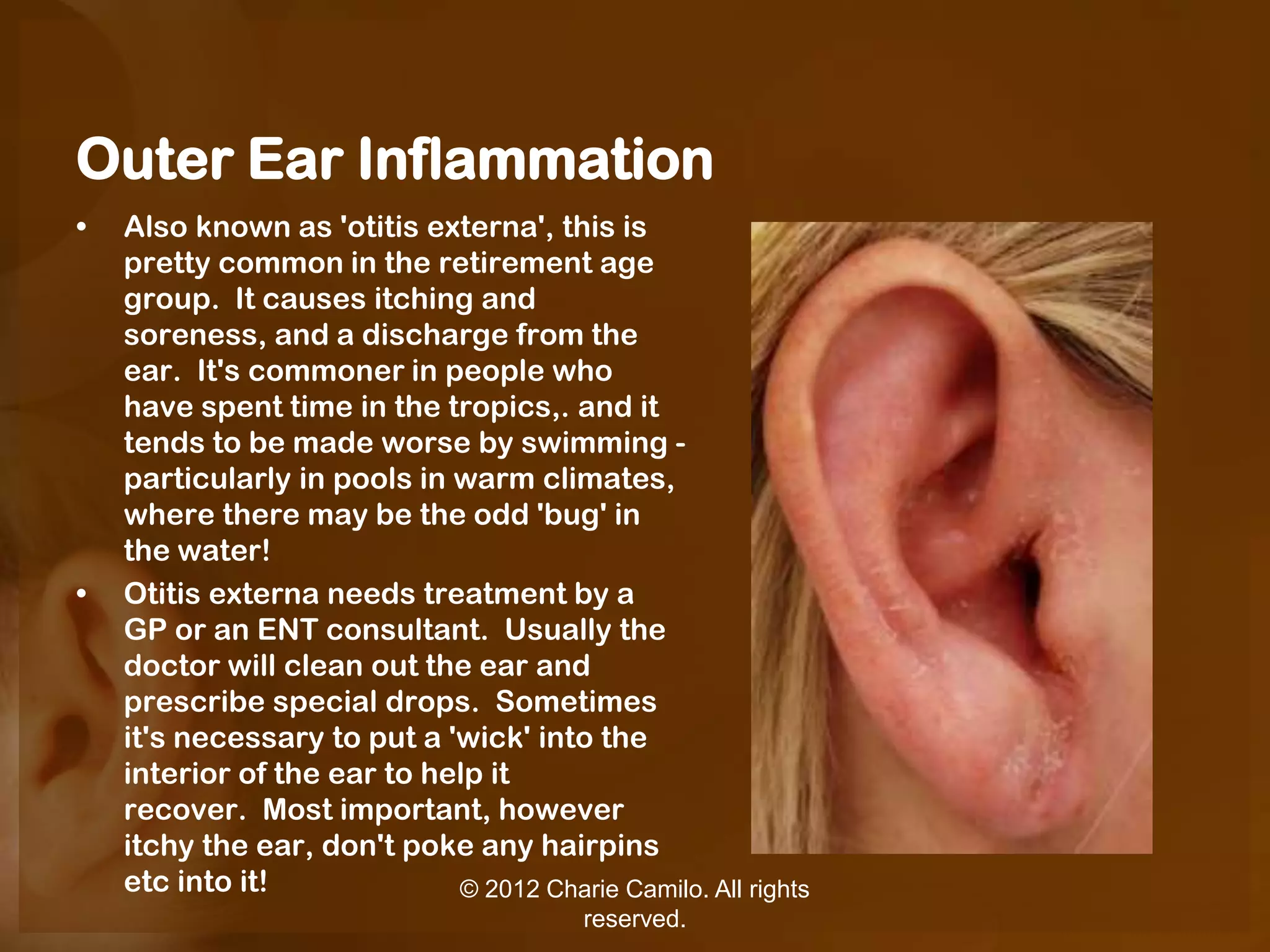 All About Ears | PPTX